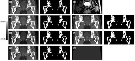 representative slice of mri derived synthetic ct images together with a