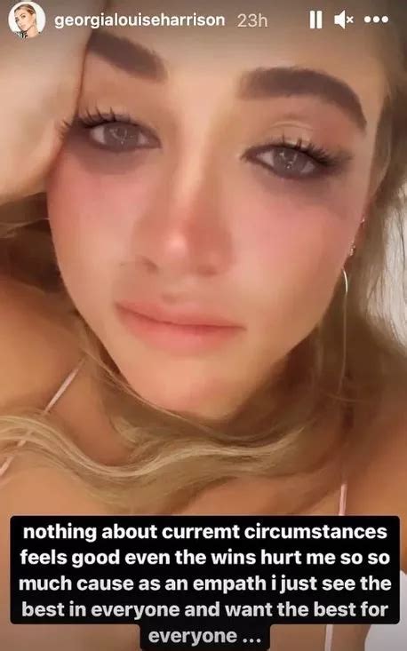 Georgia Harrisons Stephen Bear Sex Video Hell In Full Sick Discovery To Septic Shock The Mirror