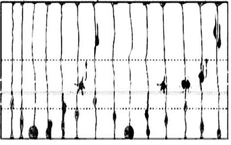 Asymmetric And Symmetric Cell Divisions Asymmetric Cell Division Download Scientific Diagram