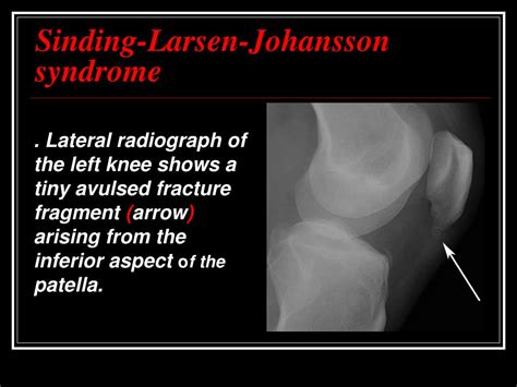 Ppt Knee Examination Powerpoint Presentation Free Download Id6361747