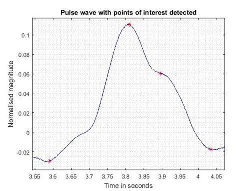 Pulse Wave Monitoring For Arterial Stiffness Detection Using A Simple Portable Tonometer Ece