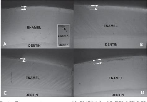 Figure 2 From Hydrolytic Degradation Of Different Infiltrant Compositions Within Different