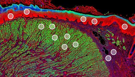 Amp 2025 Annual Meeting And Expo Pathology News
