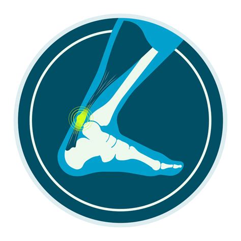 Tendonitis Treatment Stem Cell Therapy Reviews