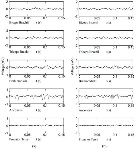 Figure B4 Example Of Recorded Emg Signals From Five Muscles Biceps