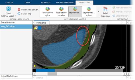 Segment CT Scan Using MONAI Label MATLAB Simulink