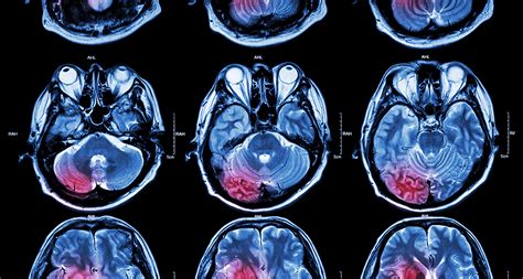 Better Future — Artificial Intelligence Is The Key To A Better Future