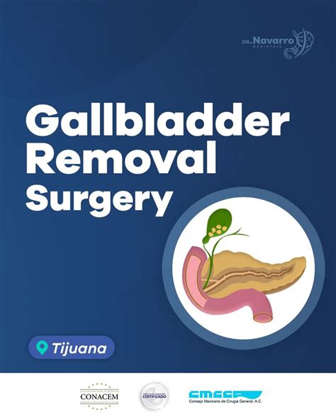 Dr 👉 Gallbladder Removal Surgery Also Known As Cholecystectomy Is A Procedure To Remove The