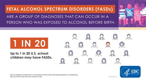 Fetal Alcohol Syndrome Pictures Symptoms Statistics