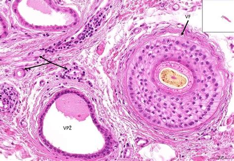 Axilla He Wikilectures