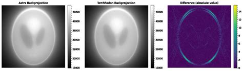 Comparison Of Forward Radon Transform With Parallel Beam Projection Download Scientific Diagram