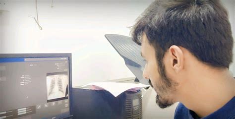 Aasim Khan On Linkedin Radiology Radiography