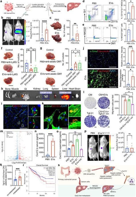 重磅！四川大学华西医院王自强、韩俊宏最新研究揭秘促进肿瘤早期肝转移的潜在机制 《转》译 转化医学网 转化医学核心门户