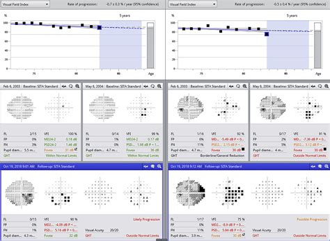 functional assessment of glaucoma uncovering progression survey of ophthalmology