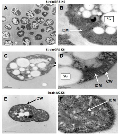 Transmission Electron Micrographs Of Thin Sections Of The Three