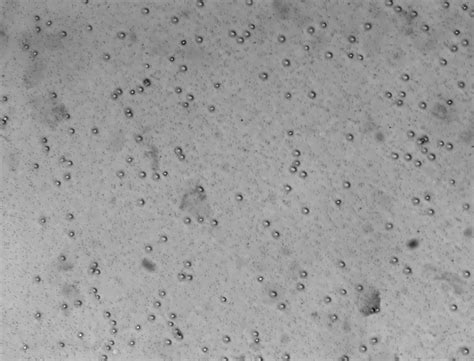 Where Are These Dots Coming From In My DAB Staining ResearchGate
