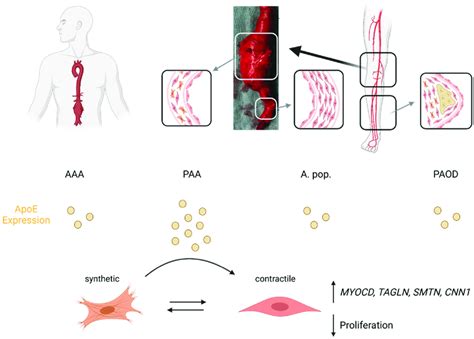 Illustrated Abstract Schematic Depiction Of Proposed Speculative