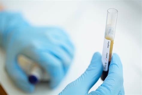 현대 장비를 사용하여 의료 샘플로 의료 실험실 작업 테스트에서 여성 의사 분석을위한 실험실 의료 장비 의료 기기 코로나 바이러스