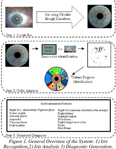 Figure 1 From MEDICAL DIAGNOSIS SYSTEM BASED ON IRIS ANALYSIS Semantic Scholar