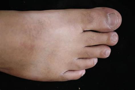 Feet Classification Classification Dataset By Semihocakli