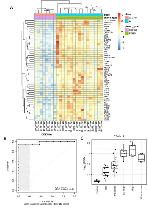 Figure 1 From Longitudinal Measures Of Rna Expression And Disease Activity In Fshd Muscle
