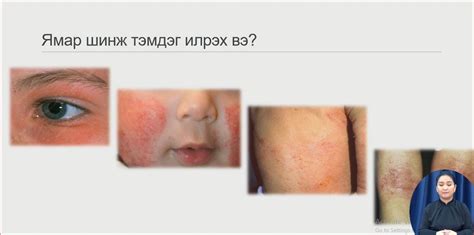 АРЬСНЫ ӨВЧИН СУДЛАЛЫН ҮНДЭСНИЙ ТӨВ