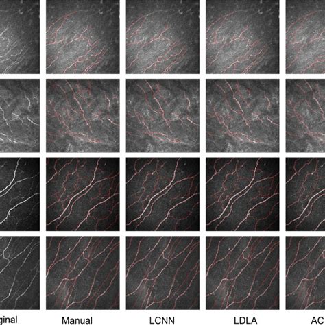 four examples of segmentation of corneal nerves columns appear in the