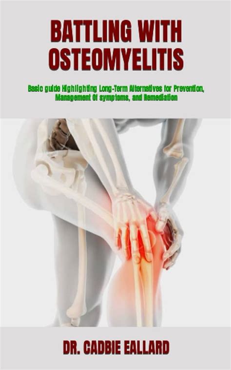 Osteomyelitis Uk Osteomyelitis In The Lower Leg X Rays Stock Image