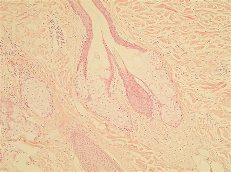 Scalp Histology Diagram Quizlet