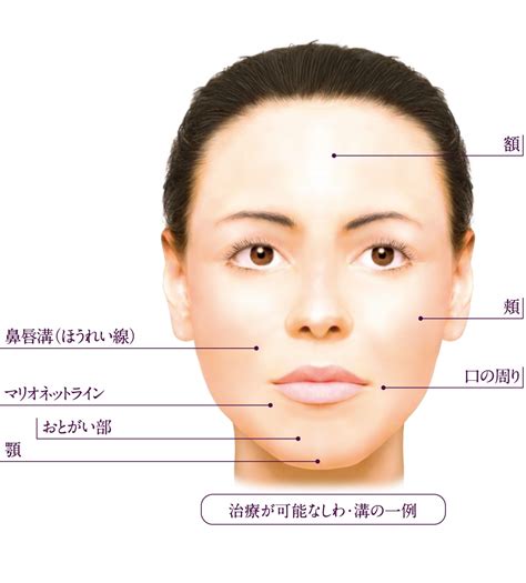 顔面イラスト 治療部位記載 八重洲形成外科美容皮膚科