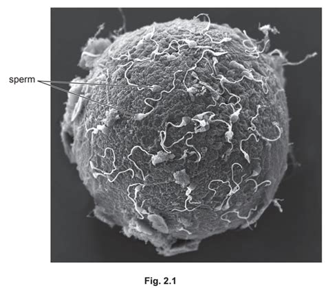 IGCSE Biology Sexual Reproduction In Humans IGCSE Style