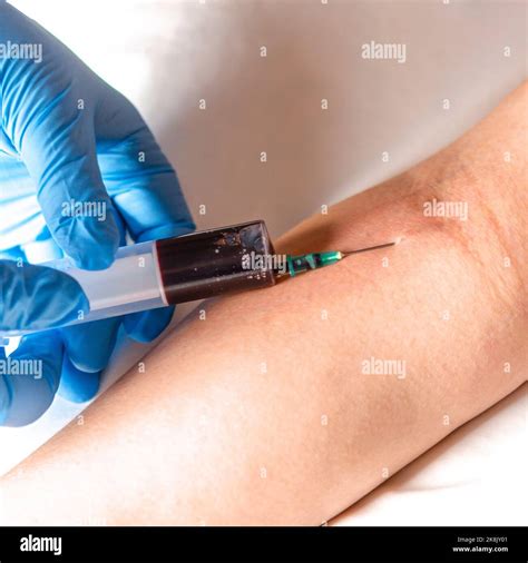 Venous Blood Sampling For Analysis In The Hospital Health Hospital
