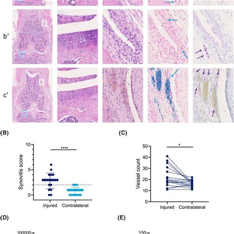 Post Mortem Evaluation Of Bone Pathology By Micro‐ct 14 D After Induced
