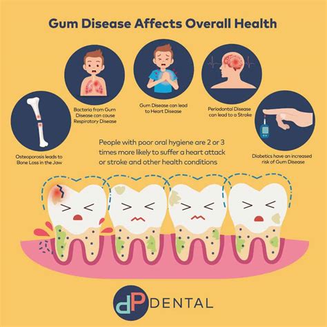 Link Between Periodontal Disease And Diabetes Dp Dental