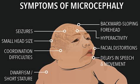 Microcephaly Birth Injury Lawyers