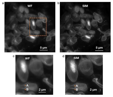 Ultraviolet Pics Push The Potential Of Nonvisible Microscopy Features Jul 2024 Photonics