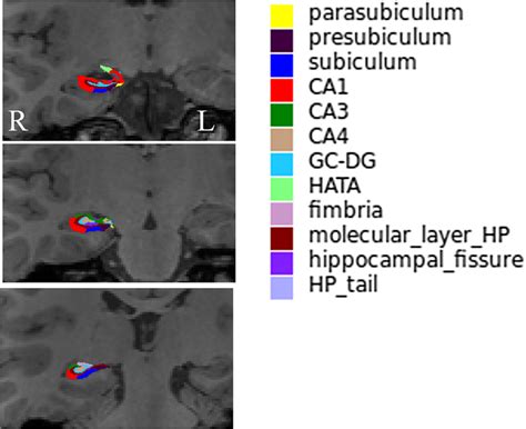 Representative Subdivision Of The Hippocampal Subfields The Mask Of