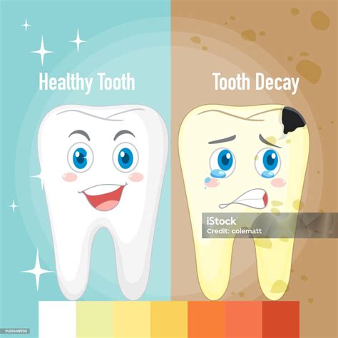 Infographic Of Healthy Tooth And Tooth Decay Stock Illustration