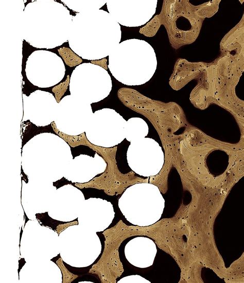Bone Cross Section 3 Photograph By Science Photo Library Pixels Merch