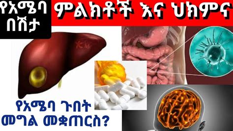 Amebiasis የአሜባ በሽታ ምልክቶች ፣ ጠንቆች እና ህክምና ዶር ሽመልስ Dr Shimels Youtube