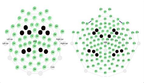 Figure 1 From Functional Connectivity In The First Year Of Life In Infants At Risk For Autism