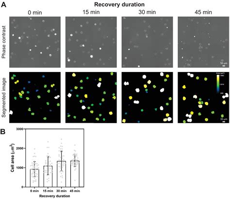 Quantitative Analysis Of Cell Edge Dynamics During Cell Spreading