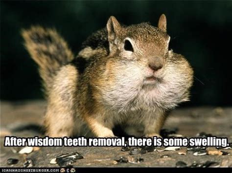 25 Wisdom Teeth Memes That Are Too Funny For Words