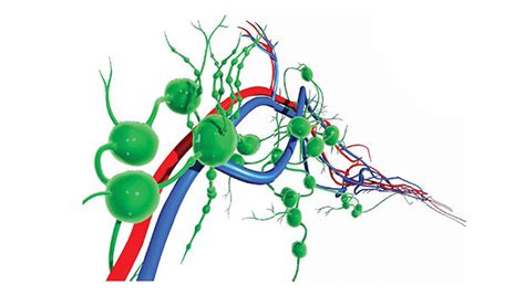 Enlarged Right Epitrochlear Lymph Node