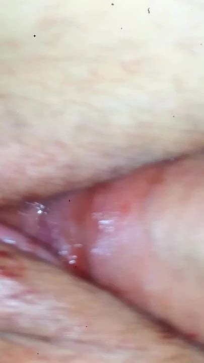 Sex Kristina Klp 25m Xhamster