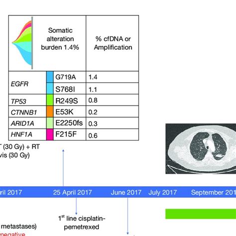 A Case Report Of A Patient With An Uncommon Double Egfr Mutation Download Scientific Diagram