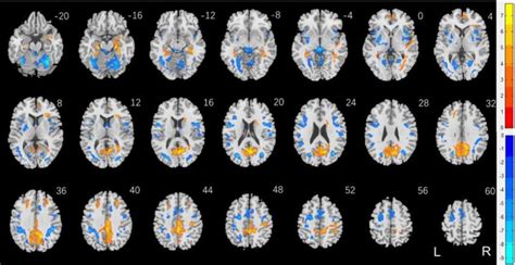 Sex Differences In Regional Responses To Reward Two Sample T Test Of Download Scientific