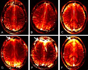 Signal Difference Maps 6 Subjects Download Scientific Diagram