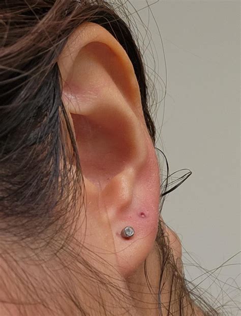 Piercing Wont Stop Bleeding After Almost 4 Weeks R Piercing