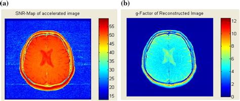 A Snr Map Of The Reconstructed Image Of Fig 8 And B The Corresponding